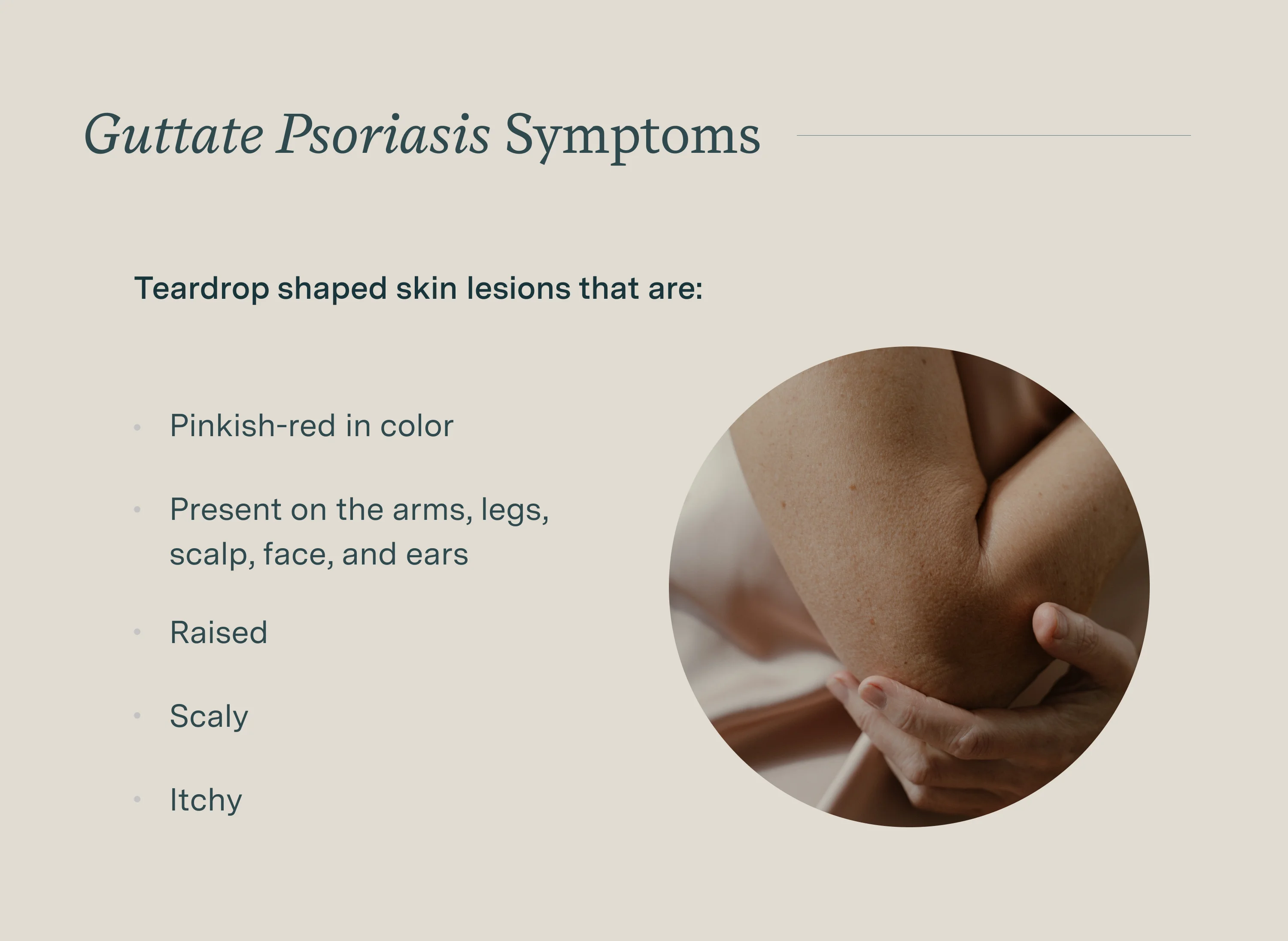 What Is Guttate Psoriasis: Causes, Symptoms & Treatments